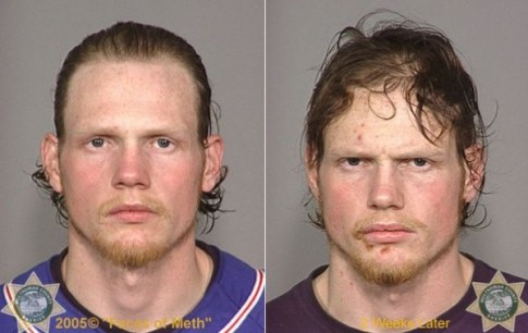 Top 33 des ravages terrifiants de la Meth en portraits avant / après