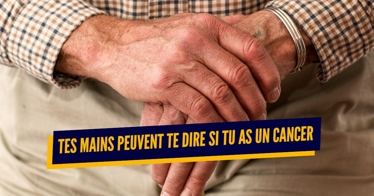 Top 10 des trucs que tes mains peuvent dire de ton état de santé